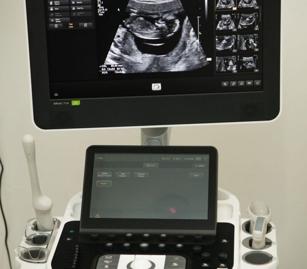 Prenatal Diagnosis: CVS or Amnio – Specialist Ultrasound for Women ...
